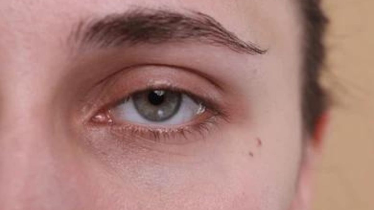 The Impact of Eye Lesions on Vision: What You Need to Know