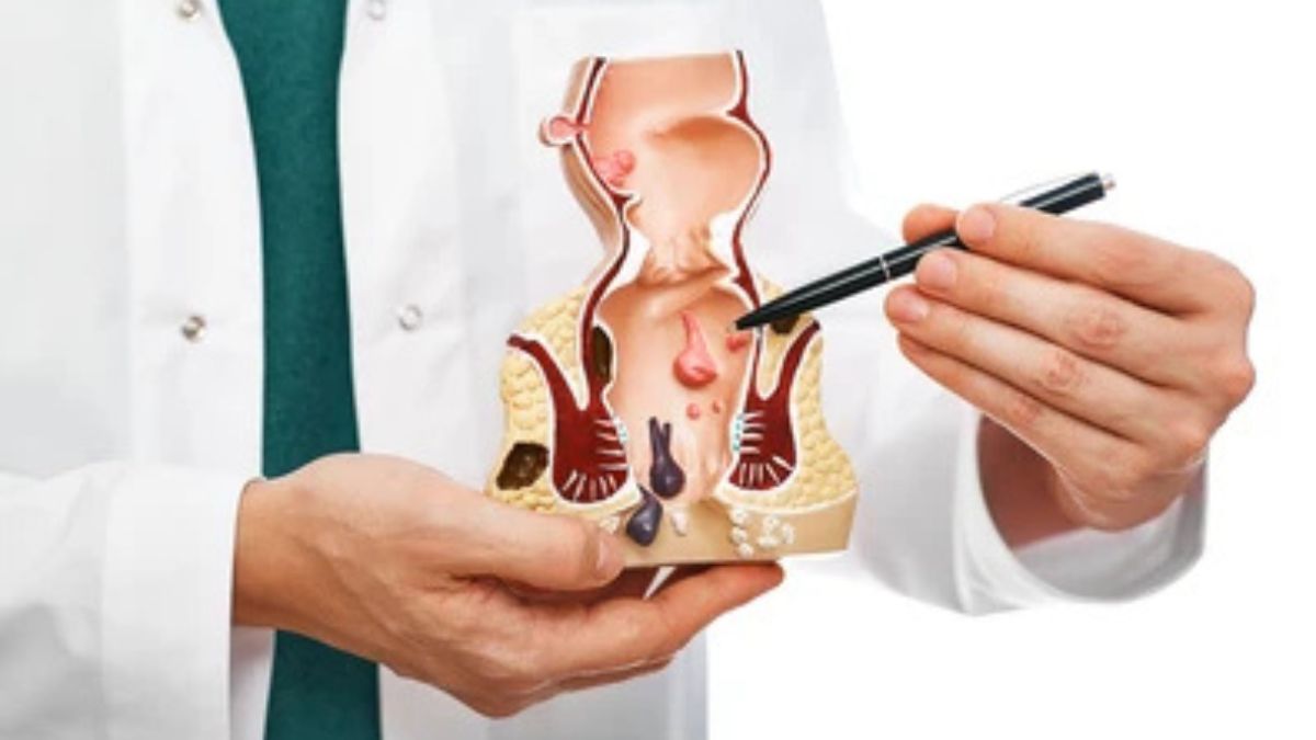 Which Treatment Can Provide Optimum Wellness for Hemorrhoid Patients?